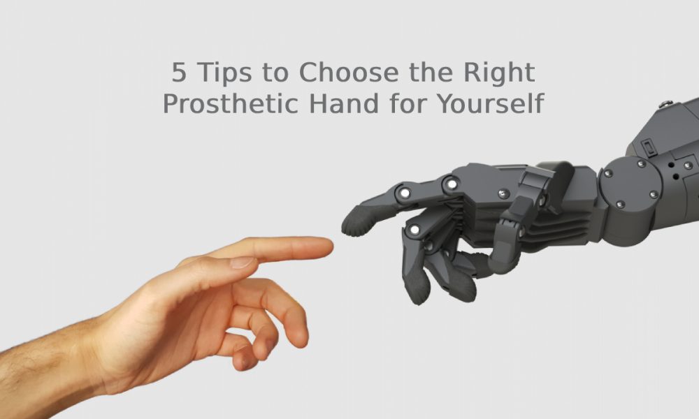 5 Tips to Choose the Right Prosthetic Hand for Yourself - Global ...